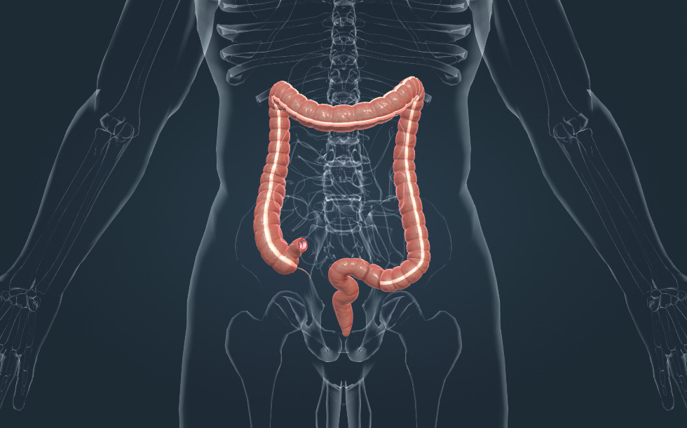 Appendicitis - 3D scene - US Mozaik Digital Education and Learning