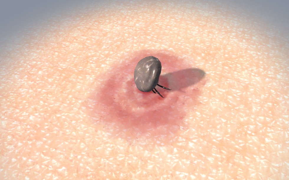 Castor bean tick - 3D scene - US Mozaik Digital Education and Learning